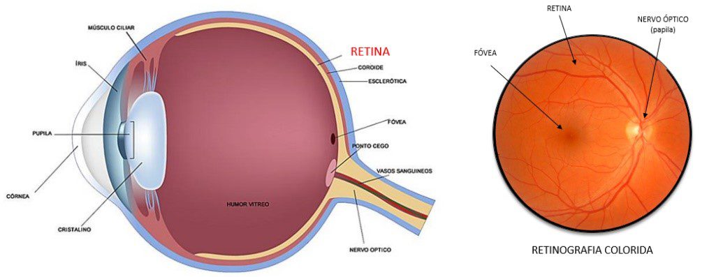 Cirurgia de Deslocamento de Retina em Blumenau - Clínica de Olhos