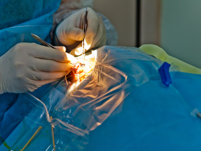 Cirurgia de Catarata: Tudo o que Você Precisa Saber!