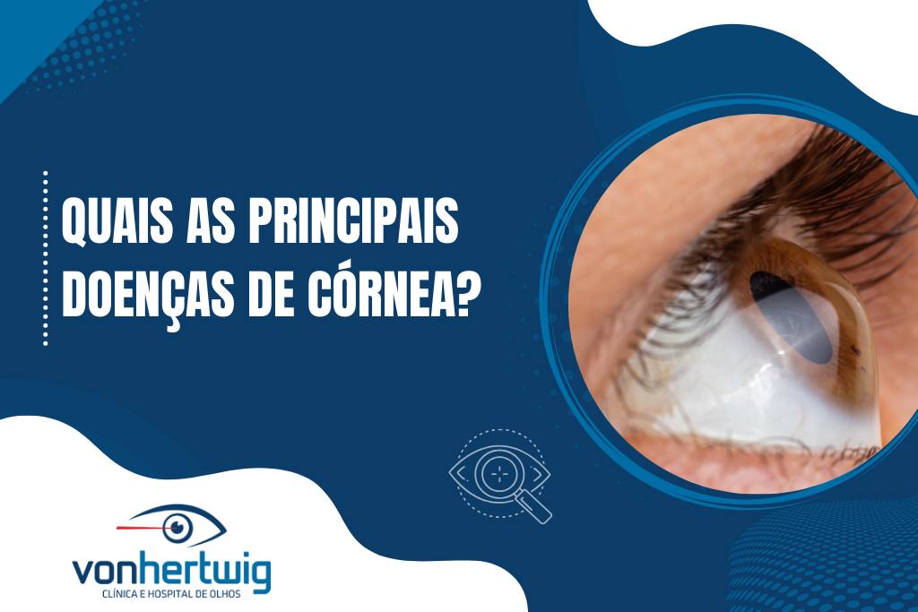 Doença de córnea: Quais as principais?